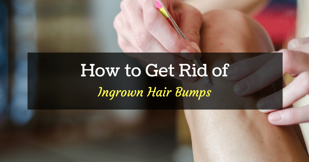 Your Guide on How to Get Rid of Ingrown Hair Bumps – TheBarbr